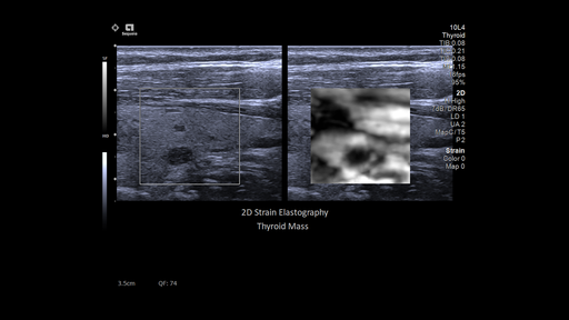 ACUSON Sequoia Ultrasound System - Siemens Healthineers