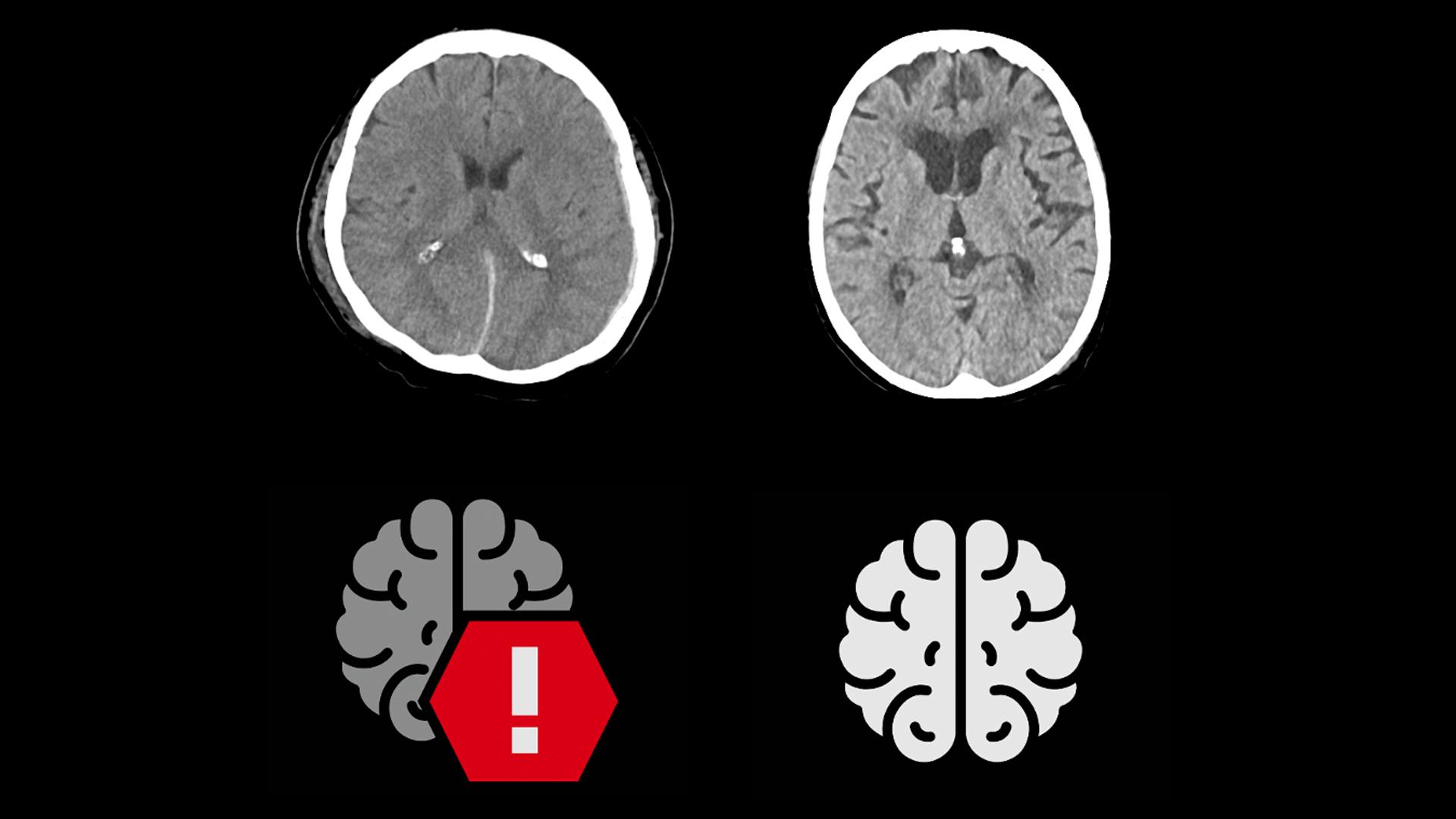 SOMATOM X.ceed with myExam Companion - Siemens Healthineers
