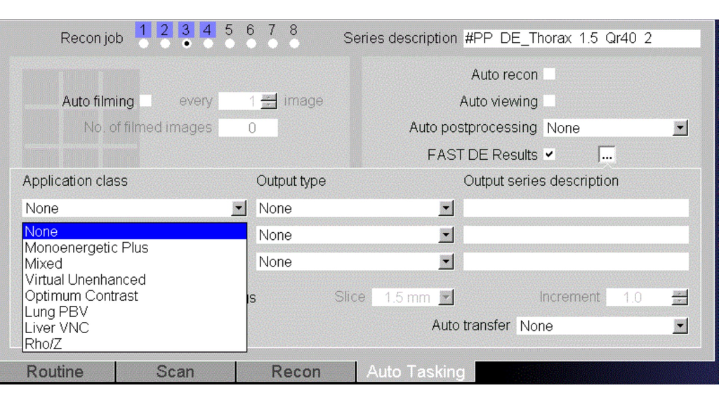 Dual Energy CT Spectral Imaging - Siemens Healthineers USA