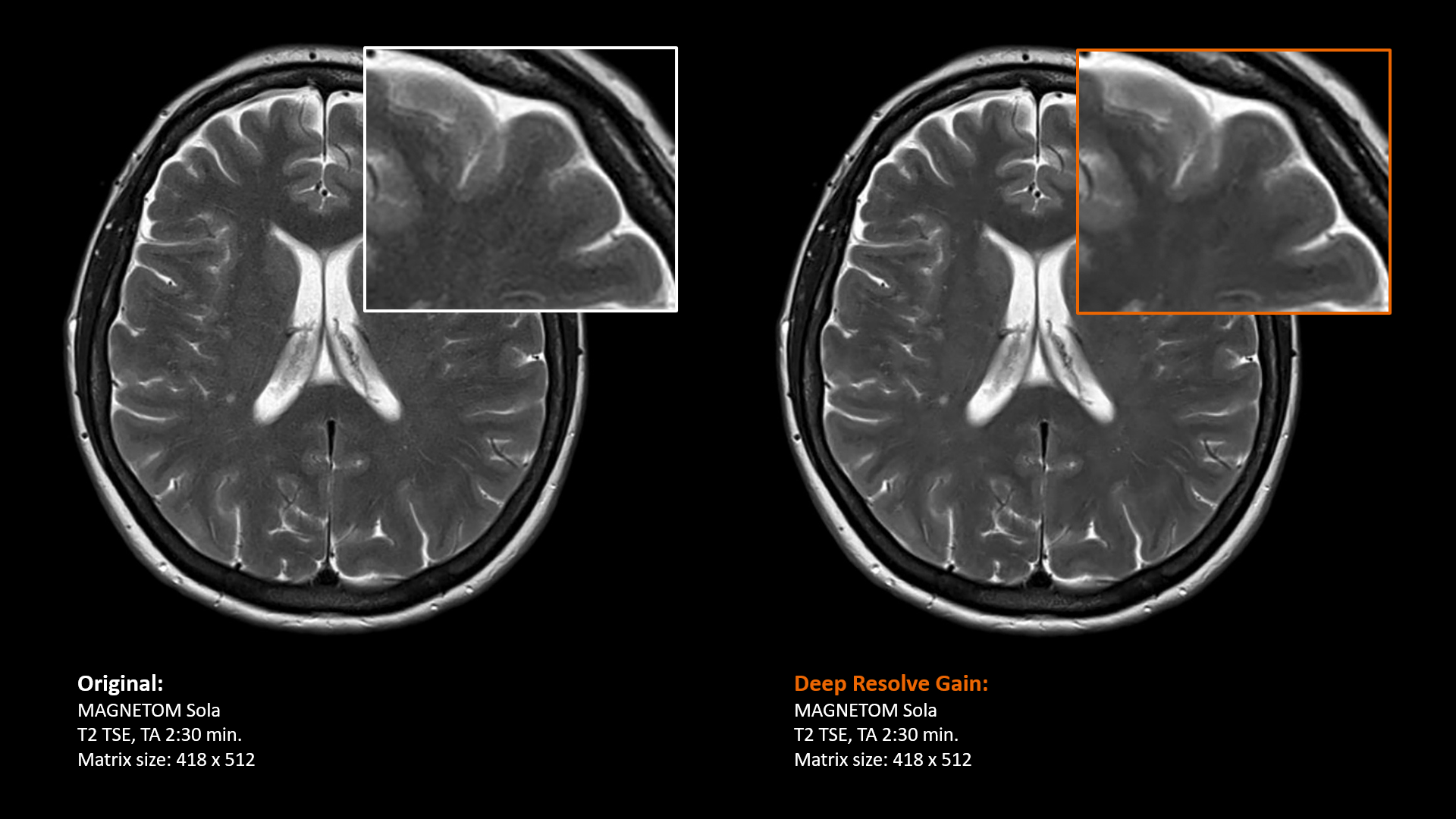 Magnetic Resonance Imaging - Clinical Software Applications - Siemens ...
