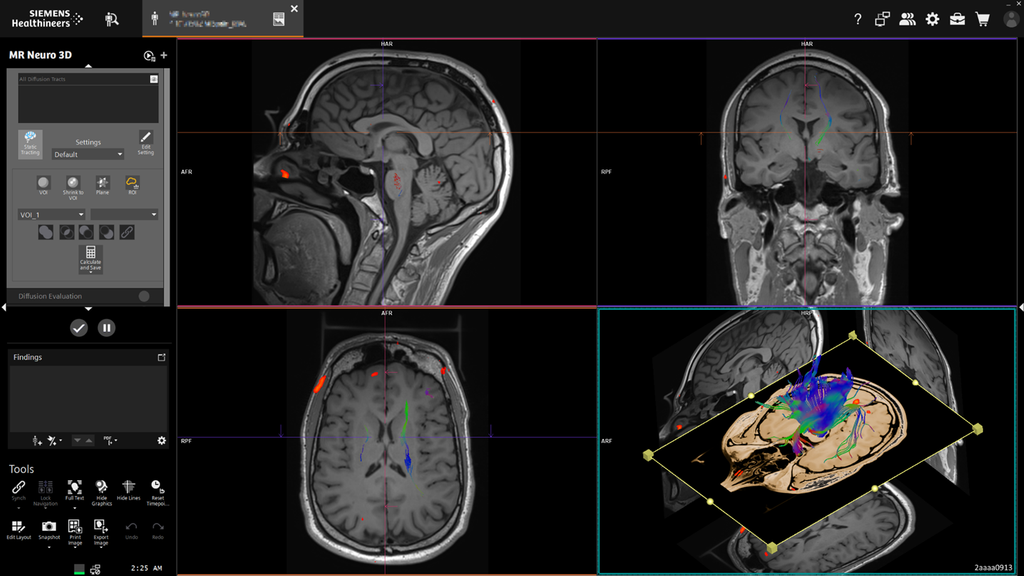 syngo.via - Siemens Healthineers India