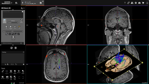 syngo.via - Siemens Healthineers USA