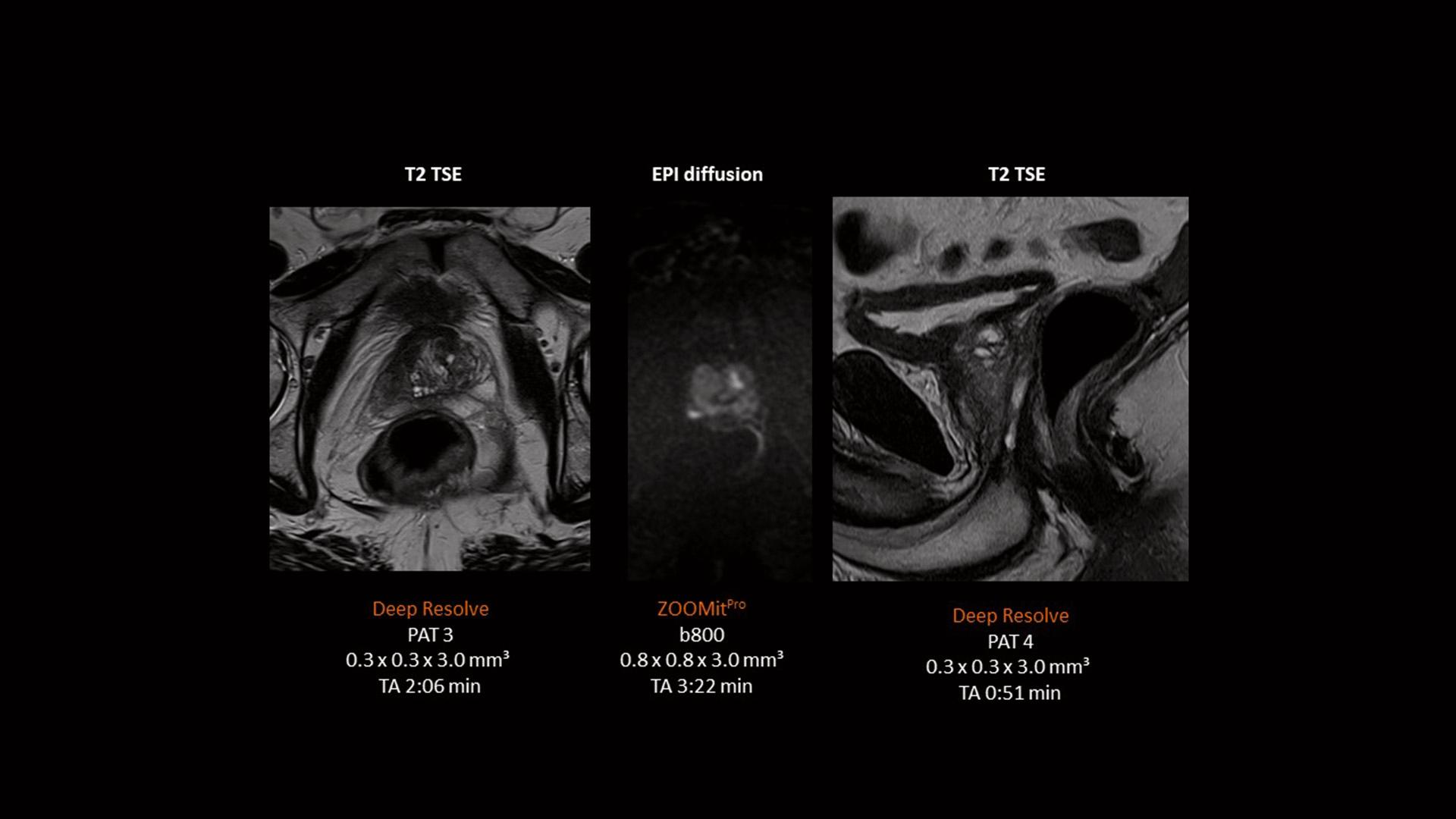 MAGNETOM Viato.Mobile - Siemens Healthineers
