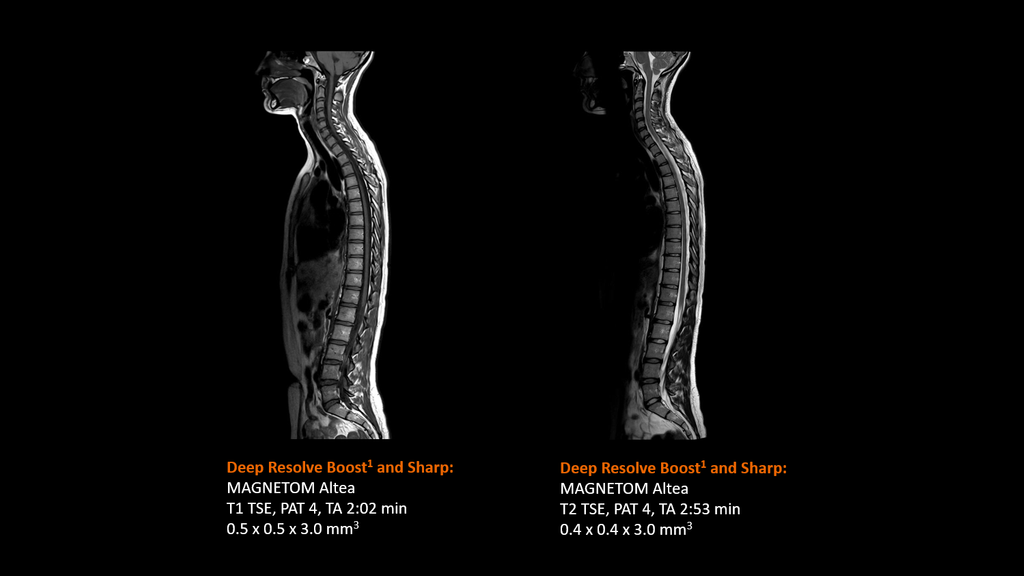 MAGNETOM Altea - Siemens Healthineers