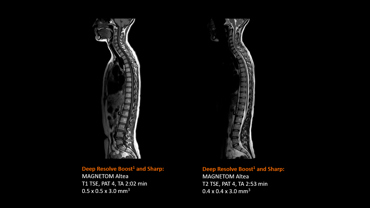 MAGNETOM Altea - Siemens Healthineers