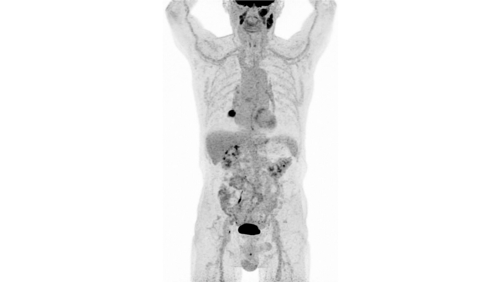 Biograph PET/CT family - Siemens Healthineers