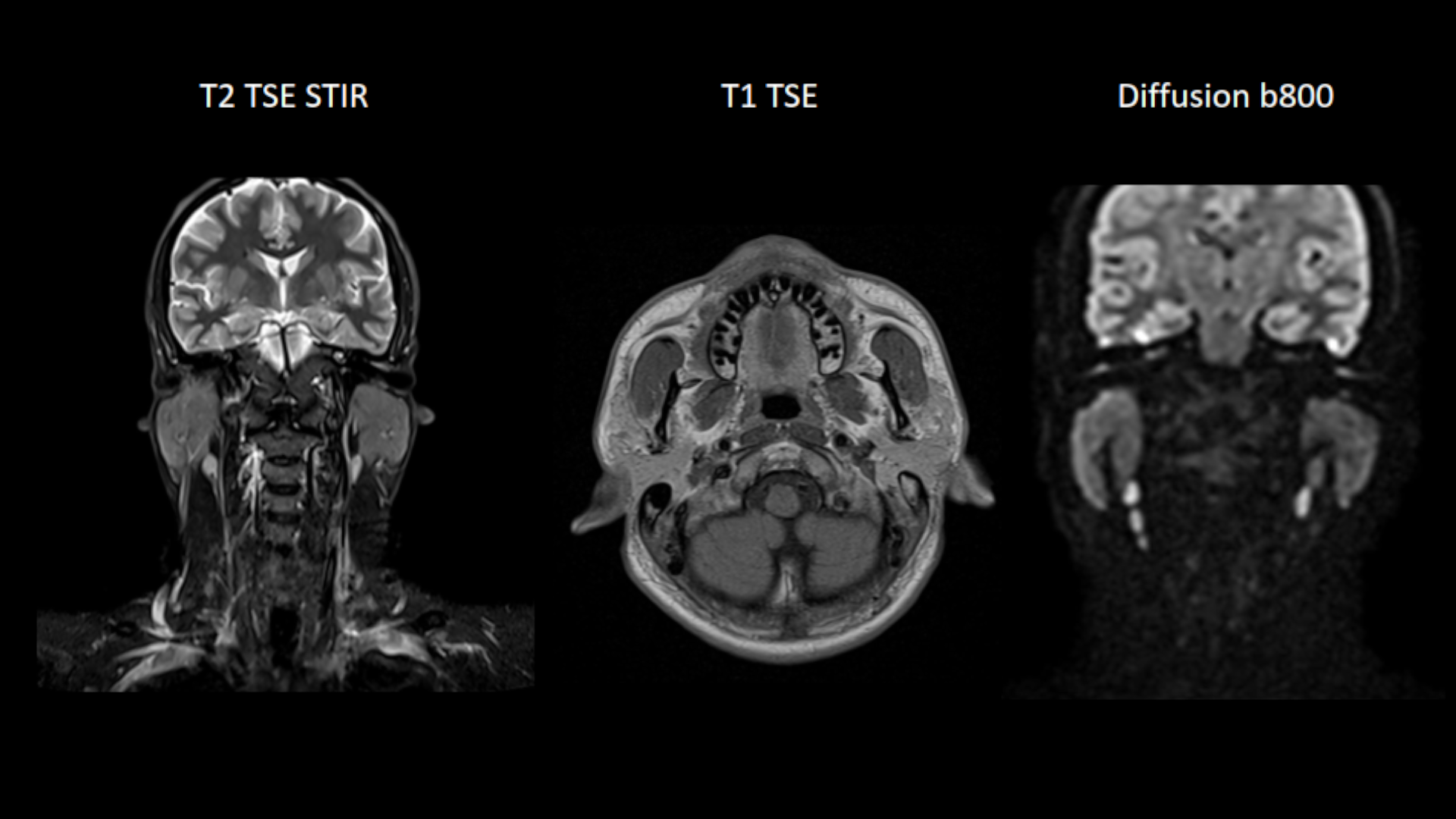 MAGNETOM Free.Star - Siemens Healthineers USA