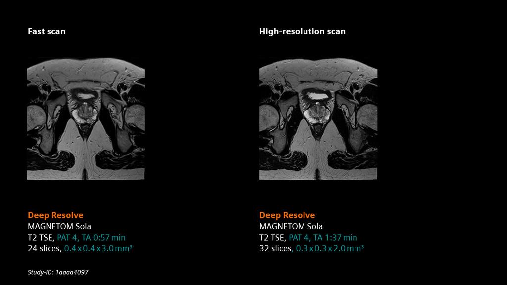 Deep Resolve – Siemens Healthineers Deutschland