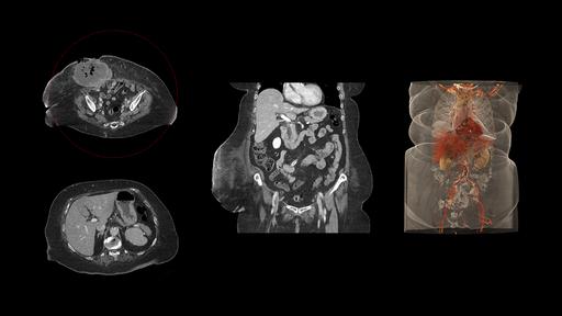 SOMATOM Edge Plus - Siemens Healthineers USA