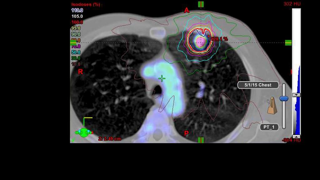 Biograph PET/CT family - Siemens Healthineers