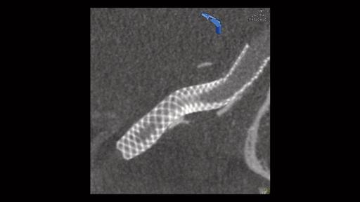 Artis Q - Siemens Healthineers