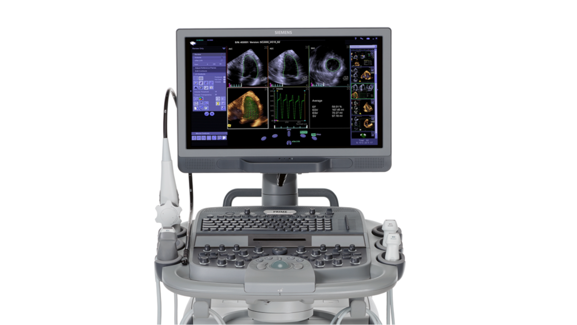 Cardiology - Echocardiography - Siemens Healthineers USA