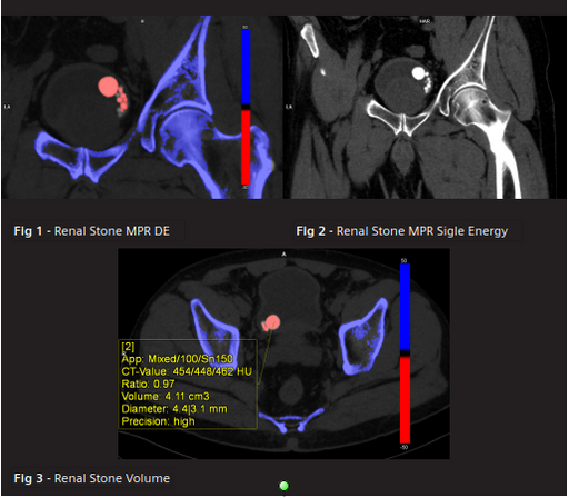 Clinical Perspectives on Modern Spectral and Dual-Source Imaging