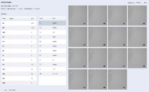 Atellica® UAS 800 Analyzer 지멘스 헬시니어스㈜