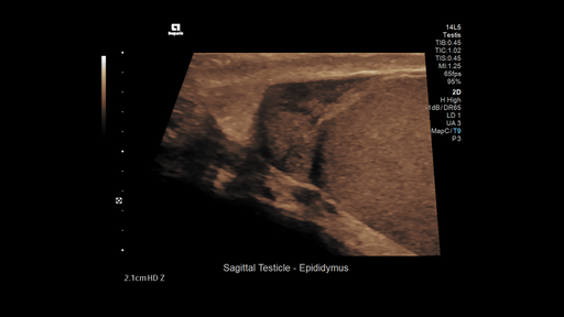 ACUSON Sequoia Ultrasound System - Siemens Healthineers