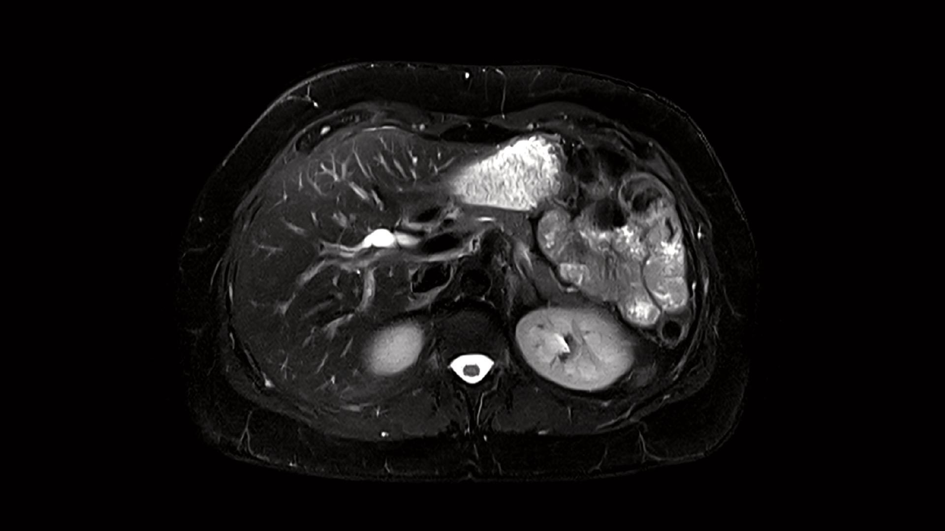 MAGNETOM Cima.X - Make the difference. - Siemens Healthineers
