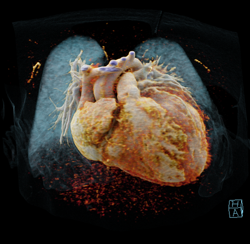 Pediatric - Computed Tomography - Siemens Healthineers USA