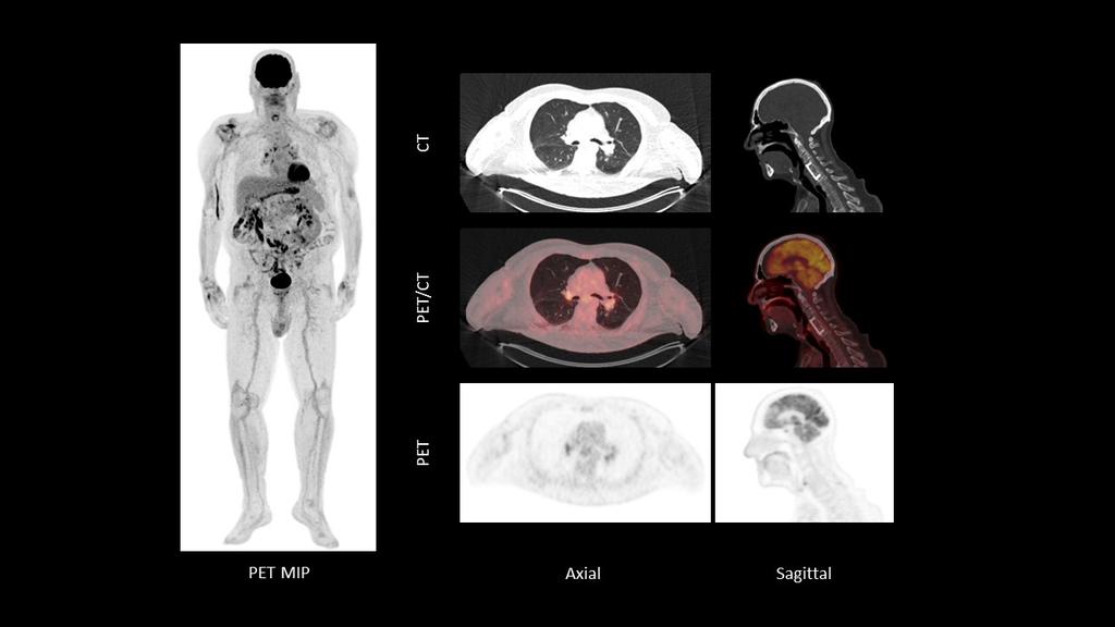 Biograph Trinion PET/CT scanner - Siemens Healthineers Japan