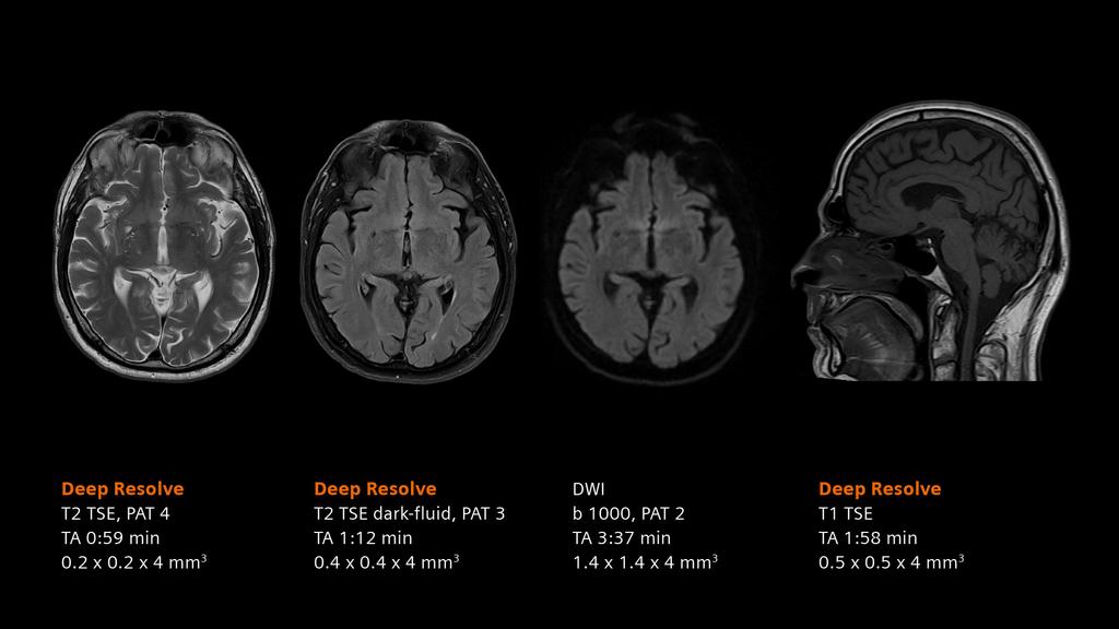 MAGNETOM Flow.Ace - Siemens Healthineers France