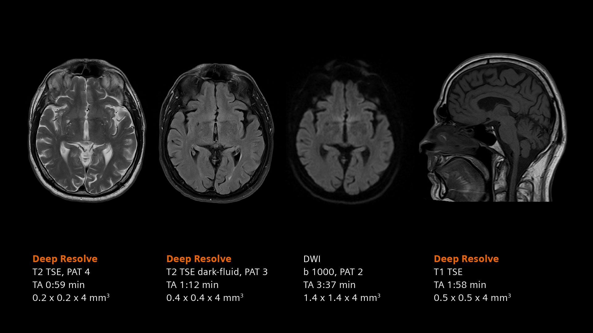 MAGNETOM Flow. Platform