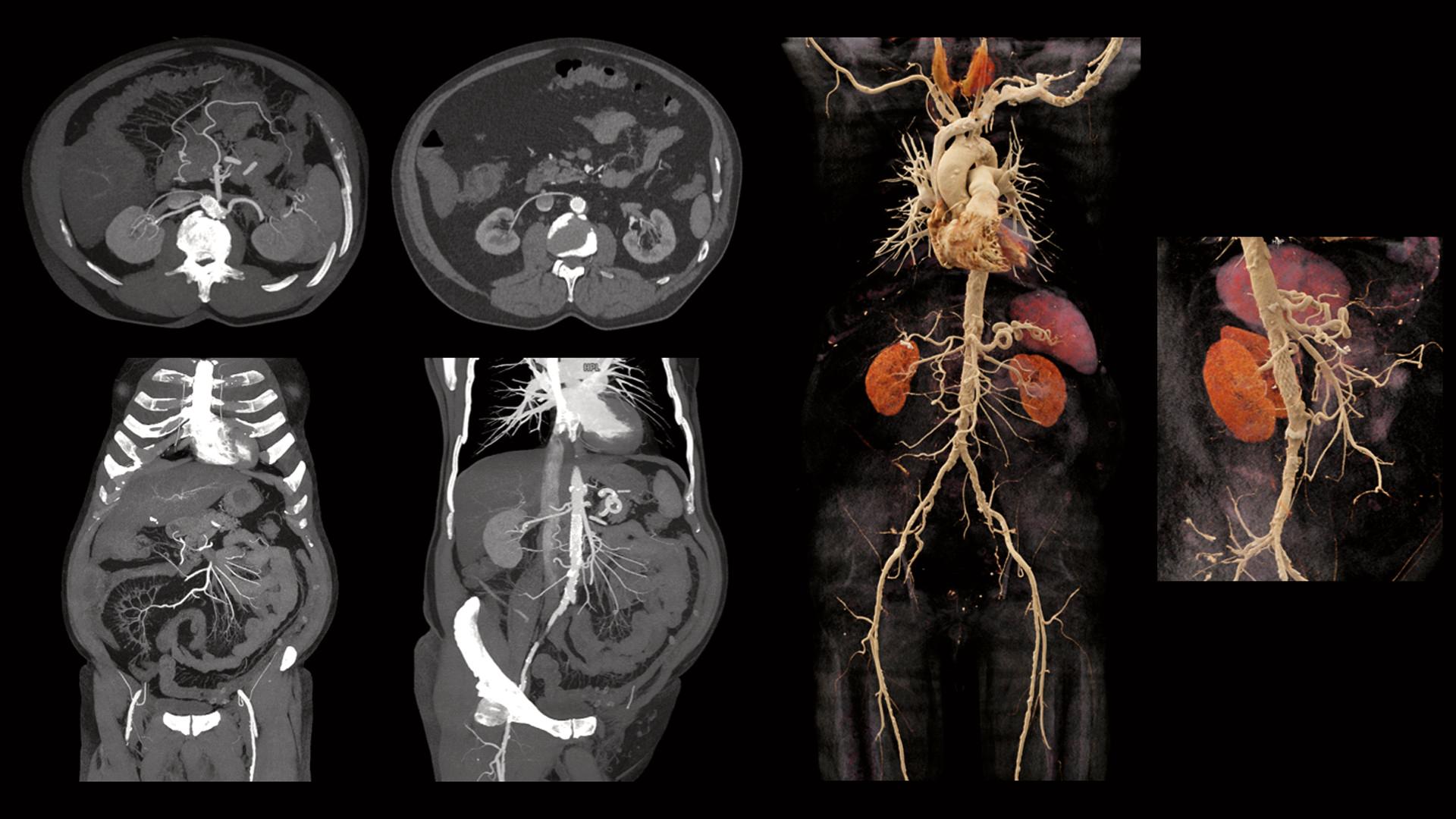 The Siemens Healthineers CT Imaging Chain - Siemens Healthineers
