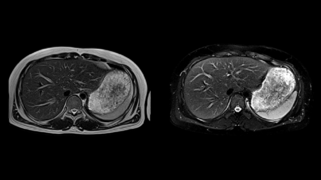 MAGNETOM Free.Star - Siemens Healthineers USA