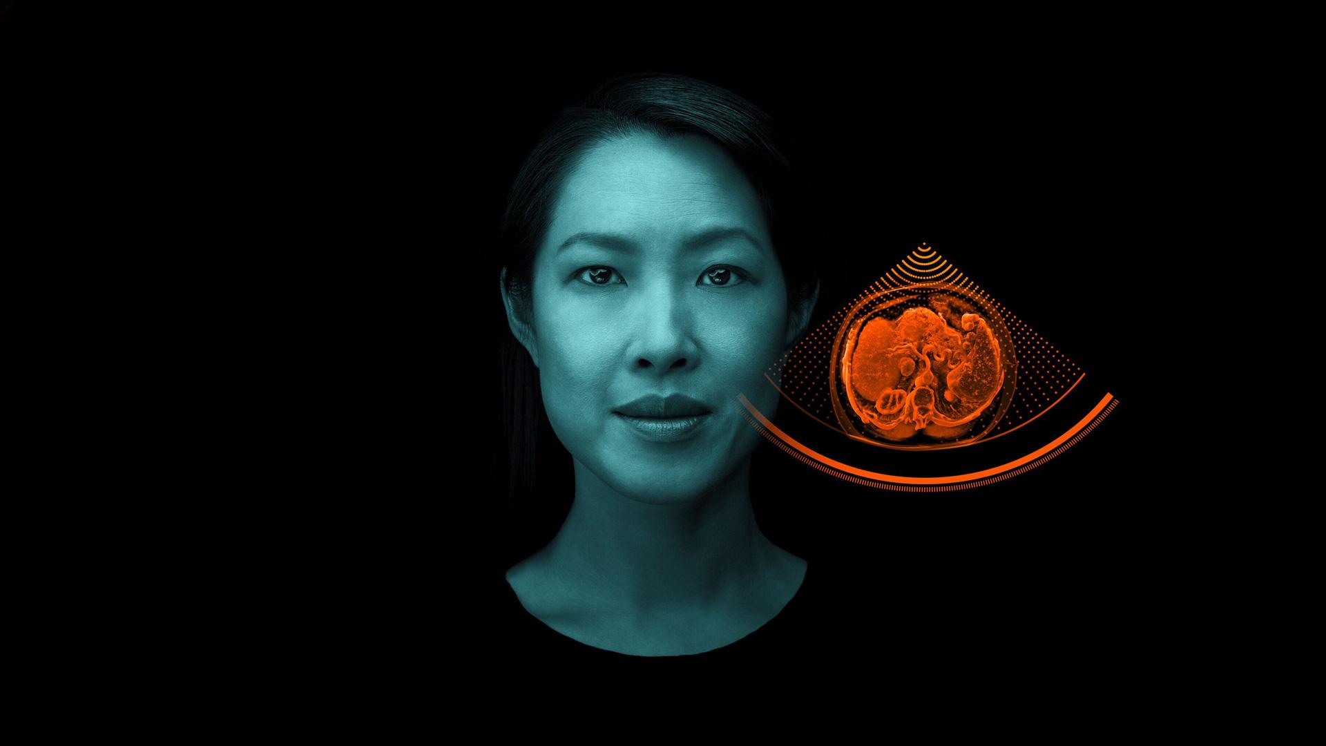 Computed Tomography for Oncology - Siemens Healthineers