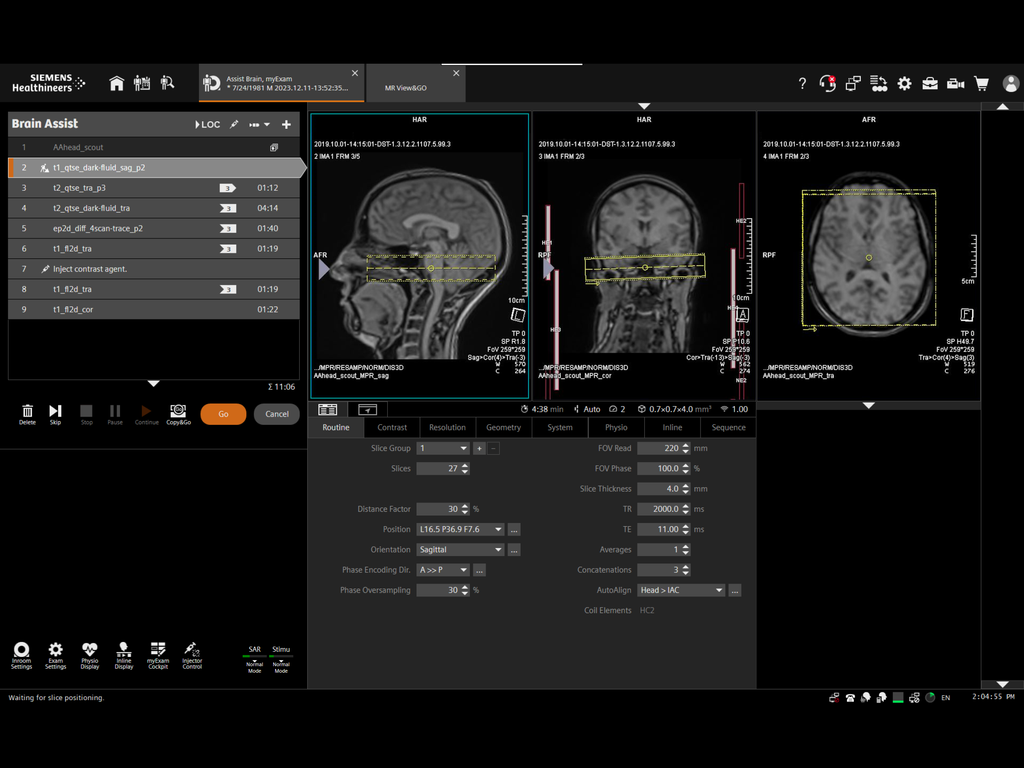 Magnetic Resonance Imaging - Siemens Healthineers Vietnam