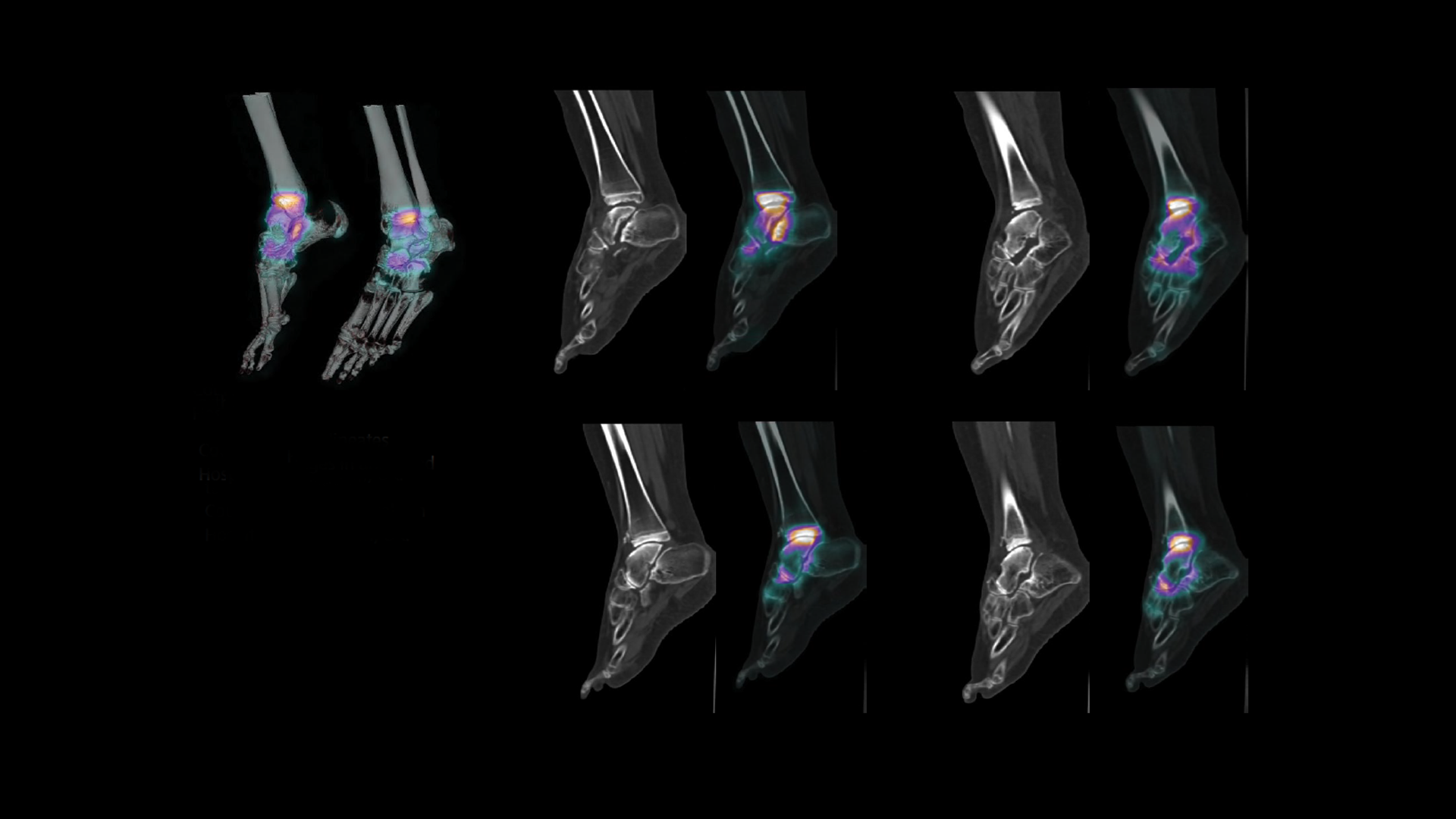Fully integrated Symbia Pro.specta SPECT/CT - Siemens Healthineers
