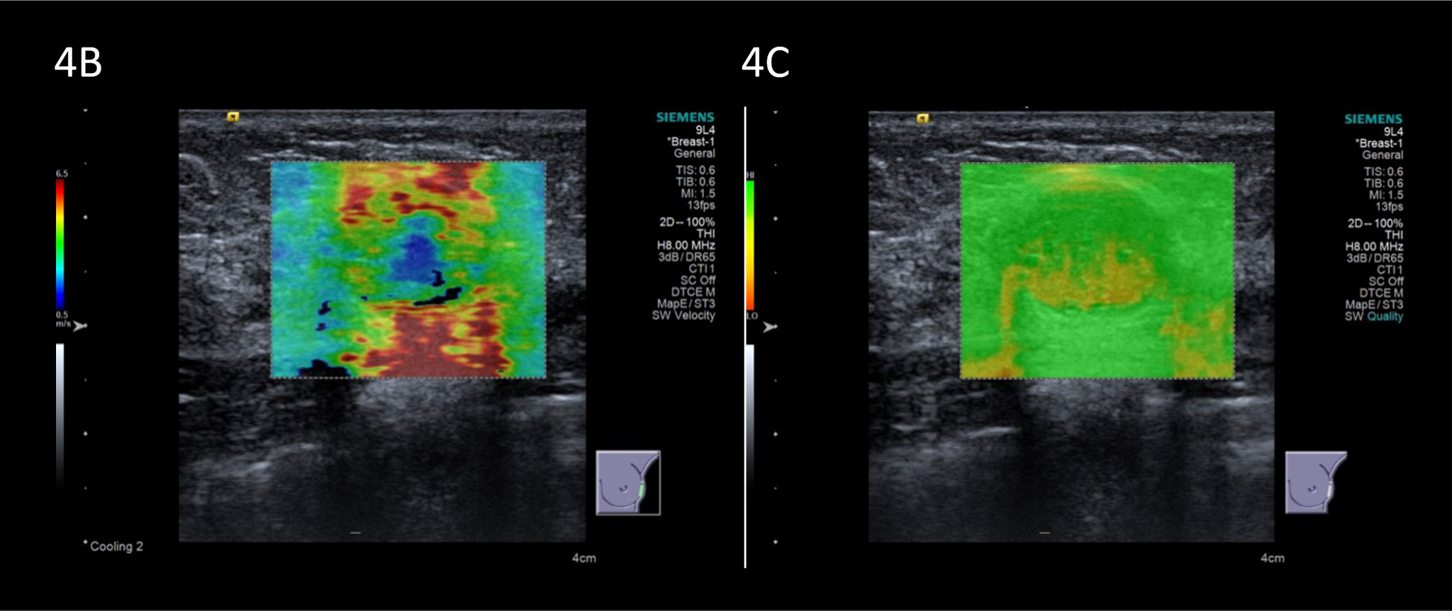 New Clinical Trends in Ultrasound Breast Imaging