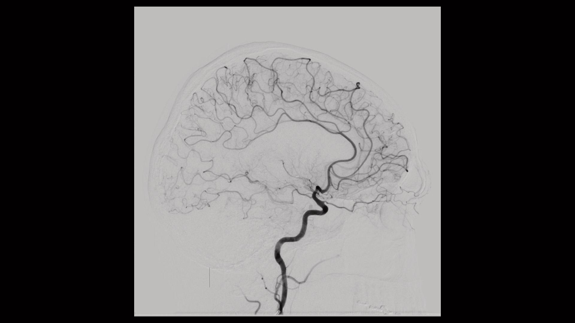 Artis Q - Siemens Healthineers