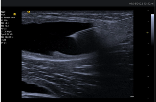 MSK Ultrasound