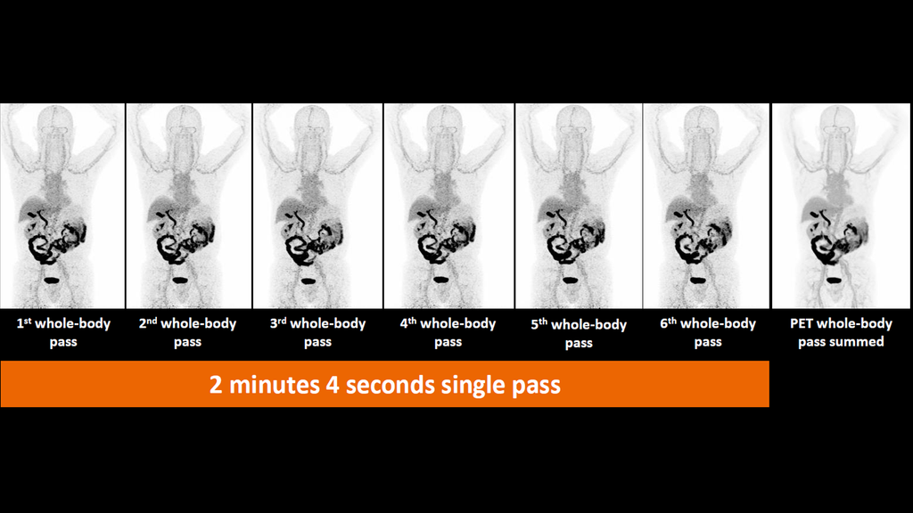 Biograph Vision PET/CT Scanner - Siemens Healthineers