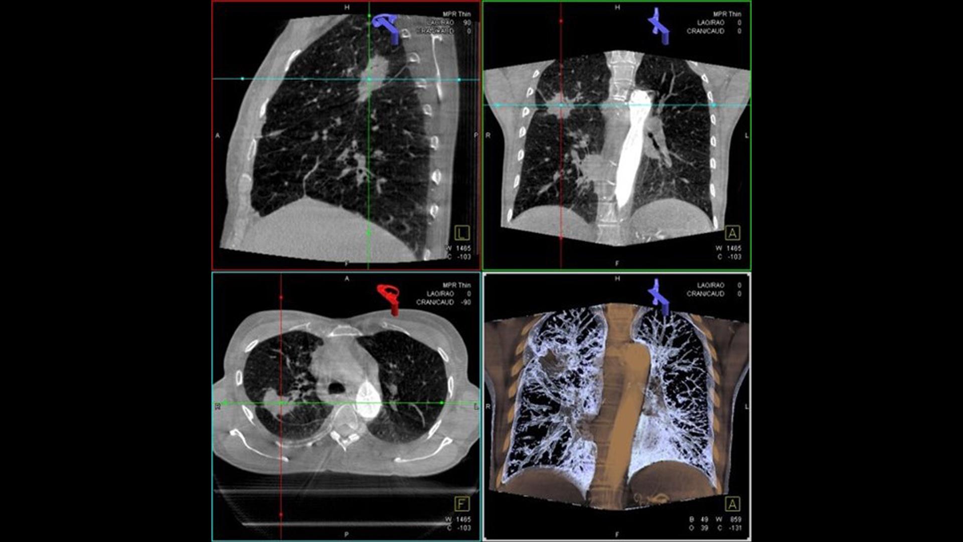 syngo DynaCT - Siemens Healthineers USA