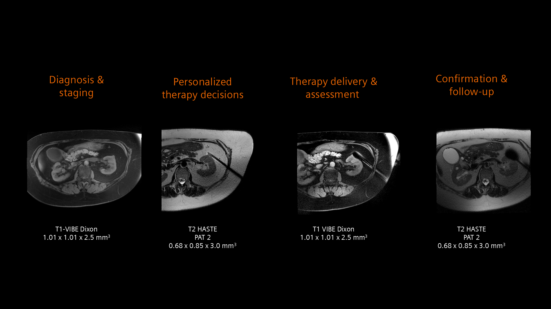Interventional MRI Suite – Leading the way in iMRI - Siemens Healthineers