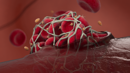 Hemostasis Learning Essentials - Siemens Healthineers