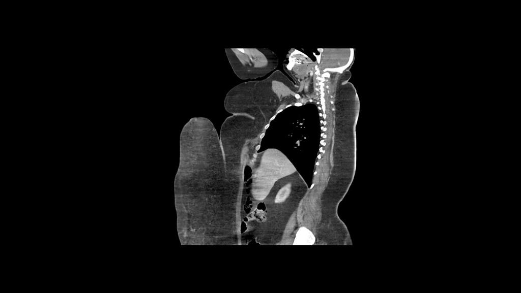 SOMATOM go.Open Pro - Siemens Healthineers