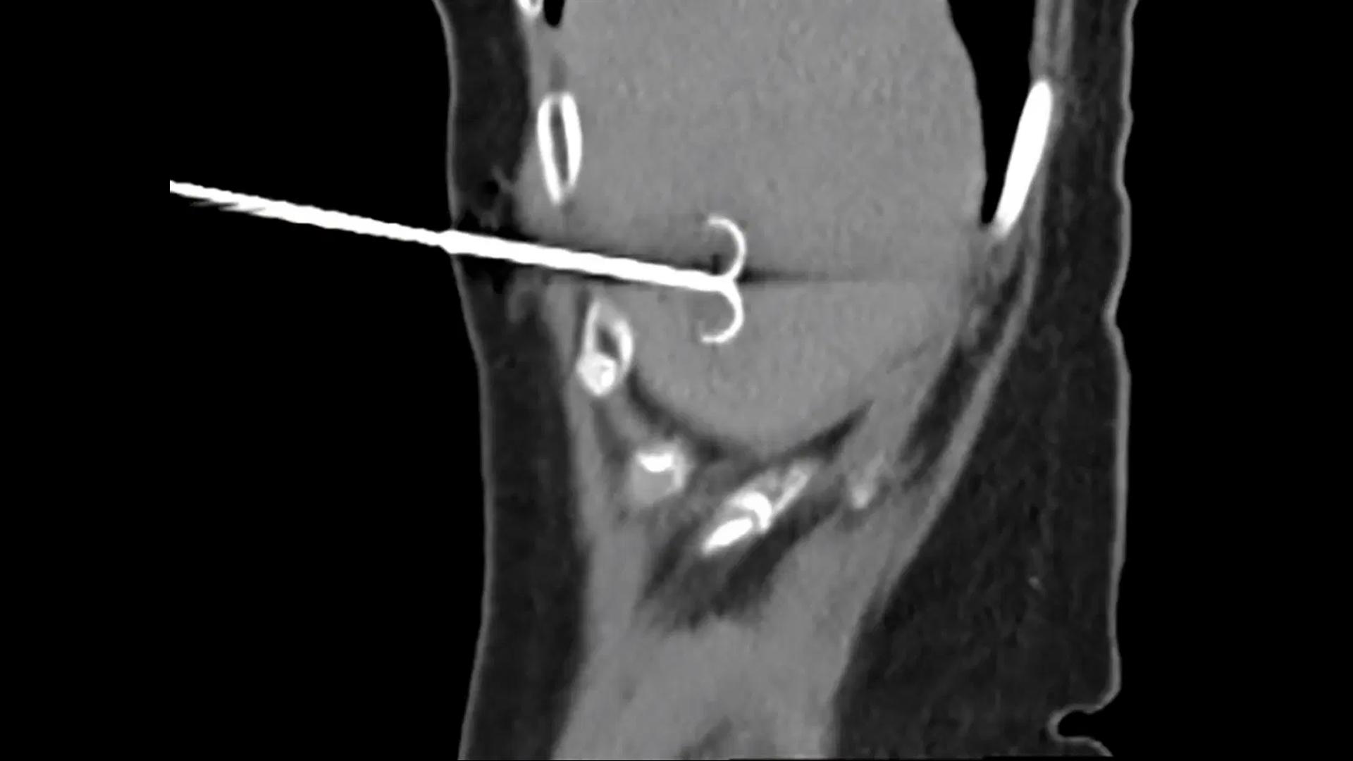 syngo DynaCT - Siemens Healthineers