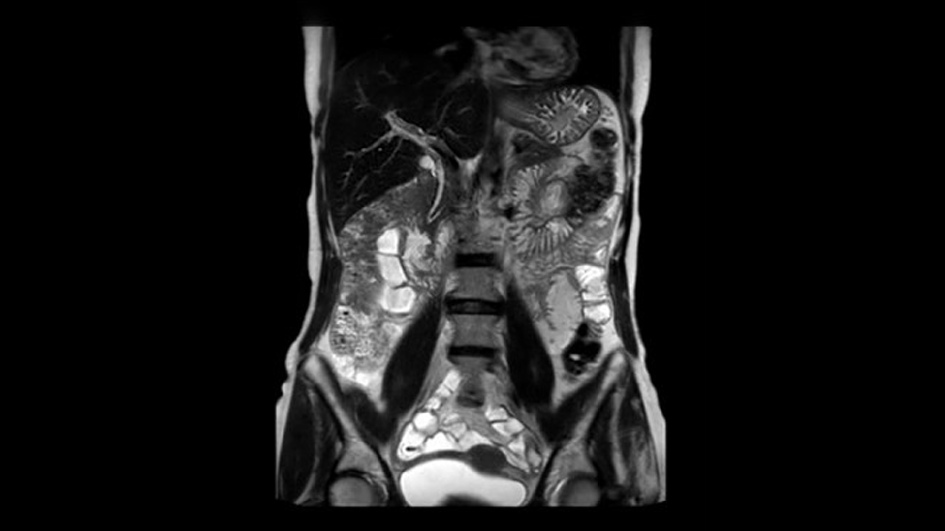 BioMatrix Technology - Siemens Healthineers