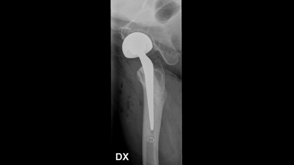 Twin Robotic X-ray scanner – Multitom Rax - Siemens Healthineers USA