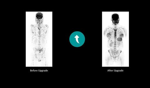 MAGNETOM Avanto Fit - Siemens Healthineers