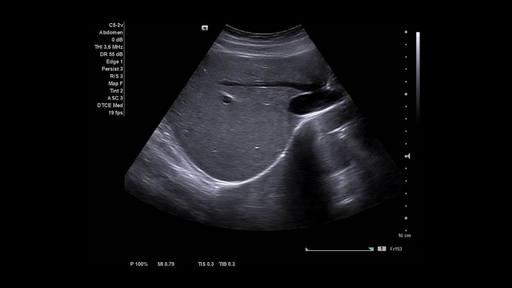 ACUSON NX2 Ultrasound System - Siemens Healthineers USA