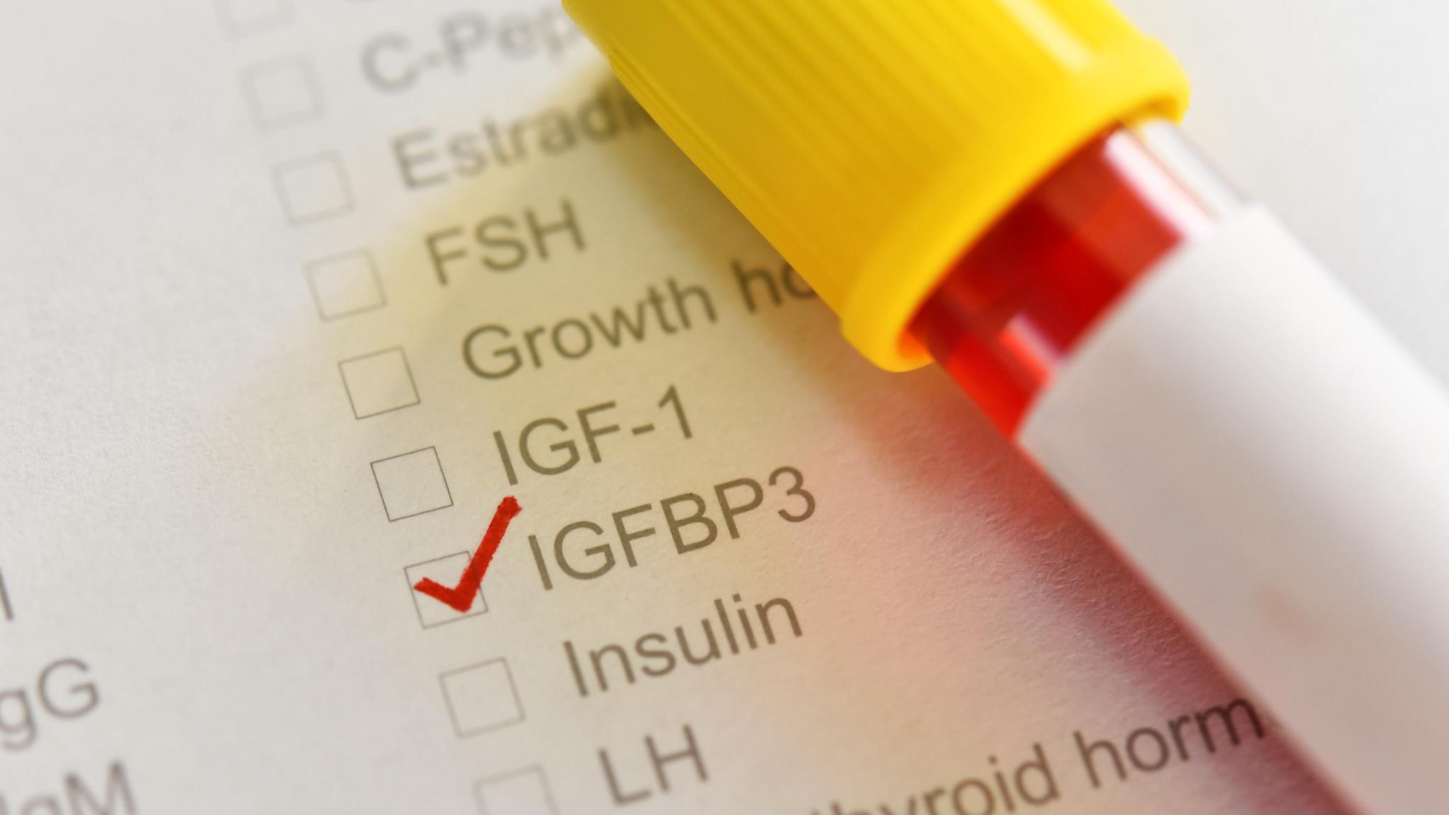 Confidently test for growth disorders - Siemens Healthineers