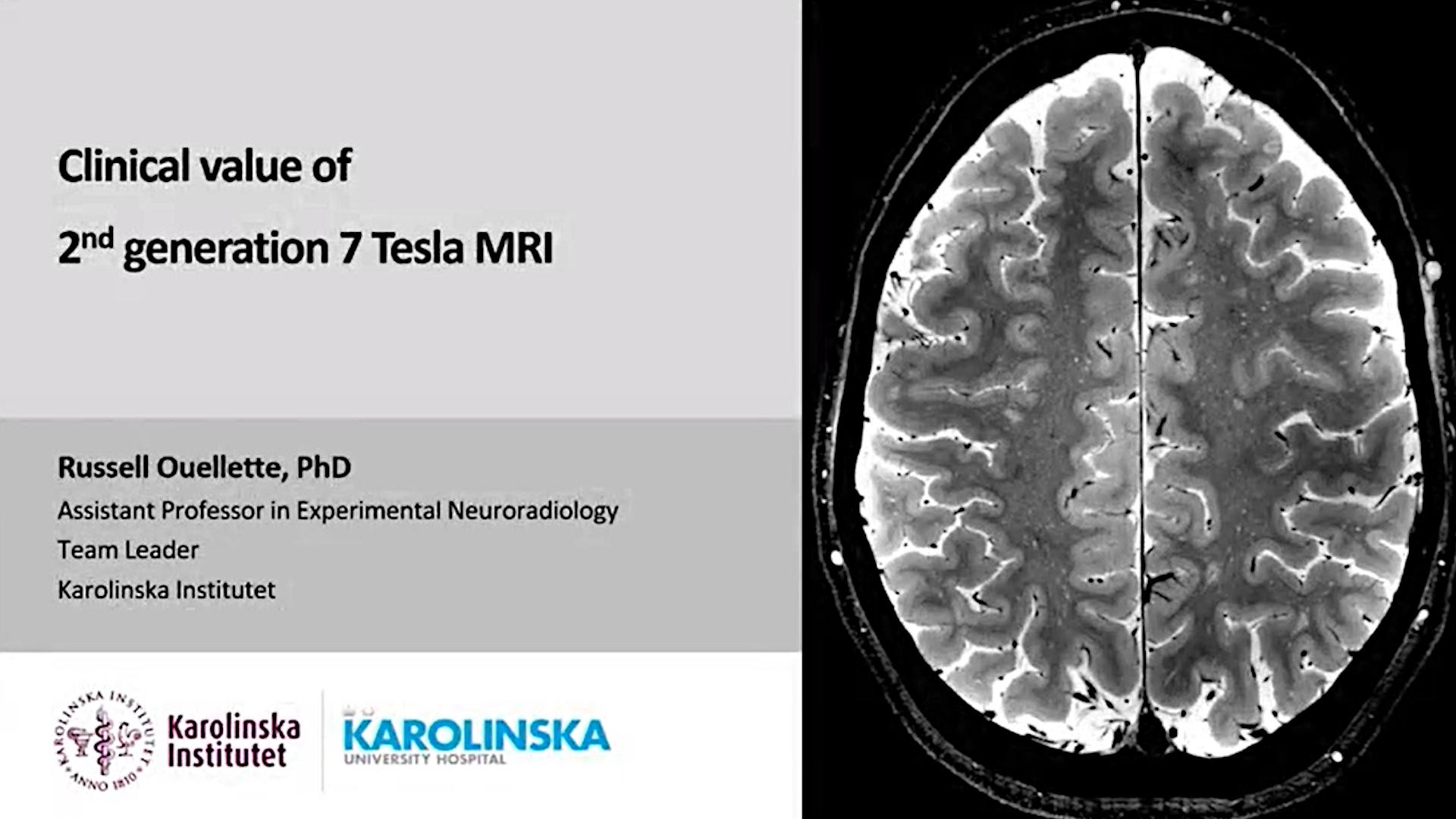 Clinical Value of 2nd Generation 7 Tesla MRI