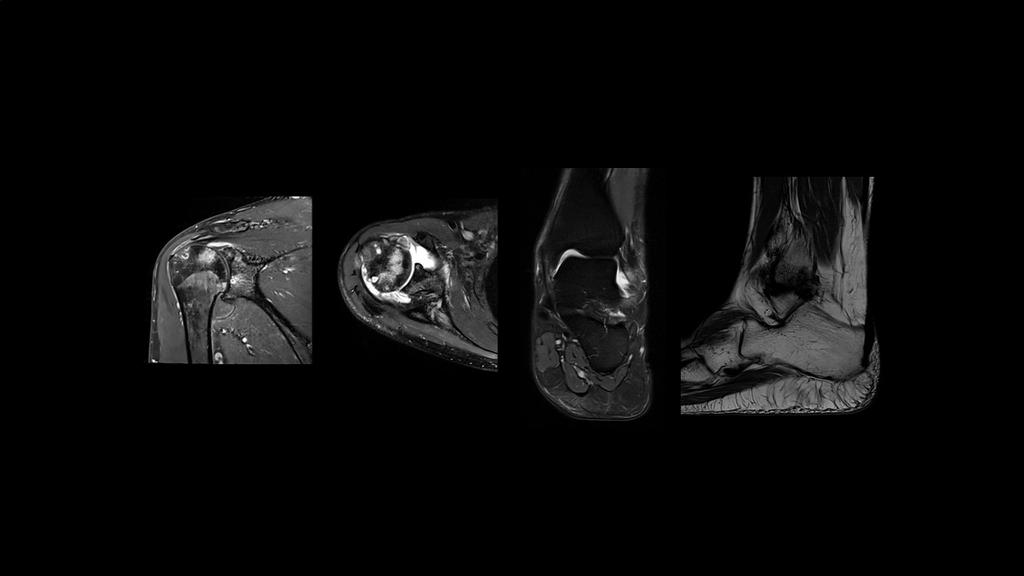 From Pixels to Picture: MR MSK - Siemens Healthineers Malaysia