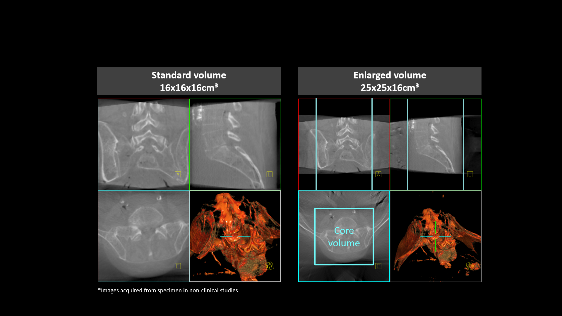 Cios Spin – Mobile C-arm machine - Siemens Healthineers