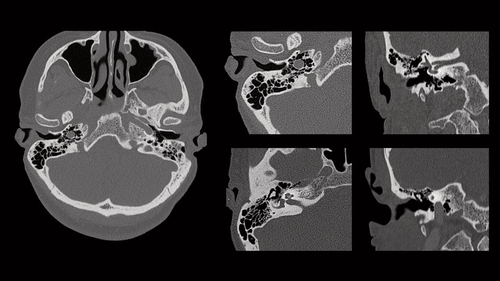 The Siemens Healthineers CT Imaging Chain - Siemens Healthineers