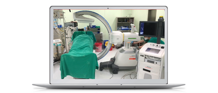 Cone-Beam CT for Bronchoscopic Interventions - Siemens Healthineers USA