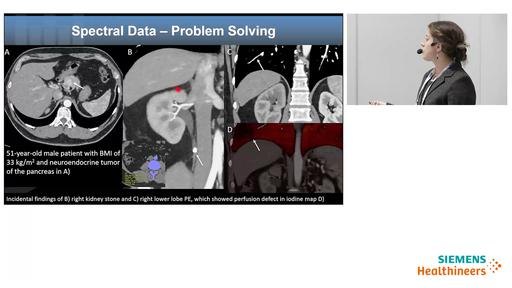 Computed Tomography Scientific Presentations - Siemens Healthineers USA