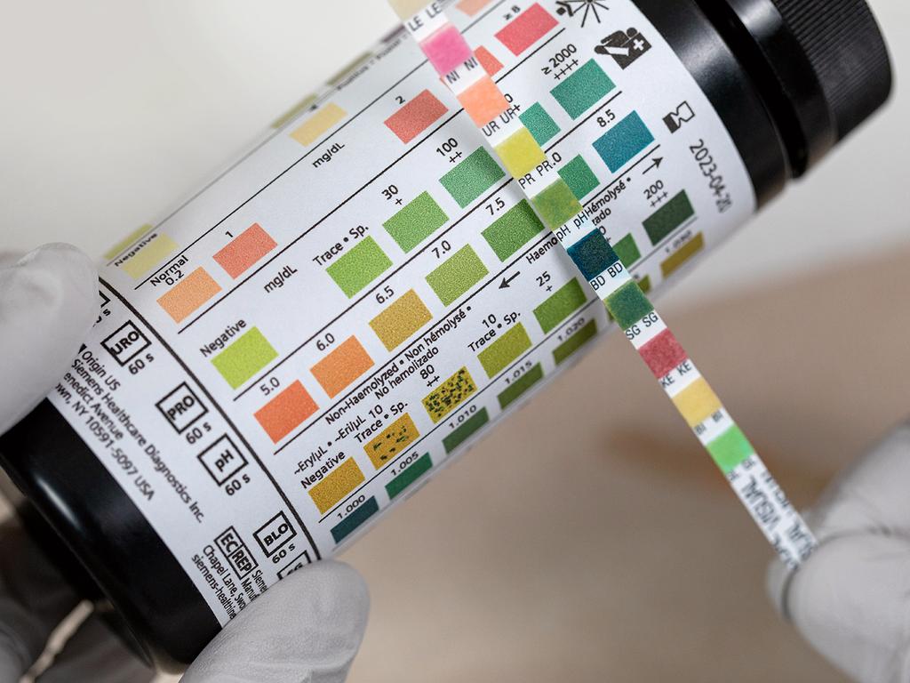 Point of Care Diagnostics